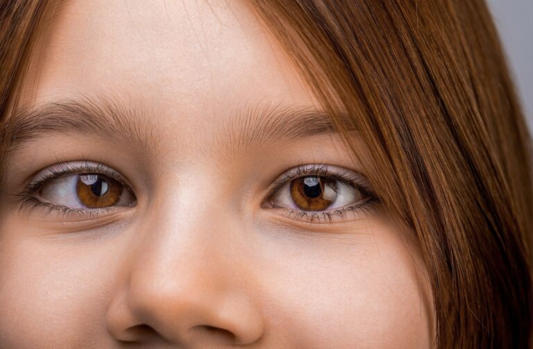 Vision Therapy For Strabismus: How Does It Work?